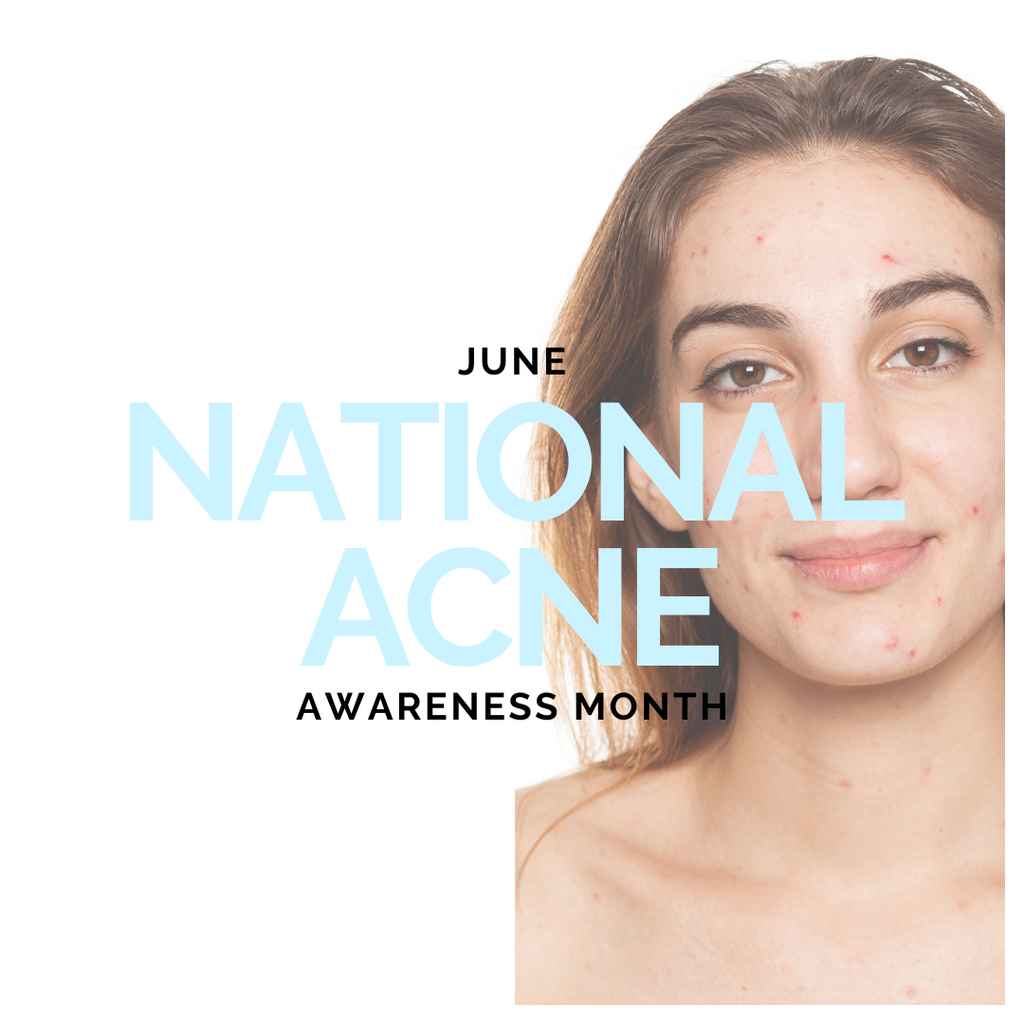 National Acne Awareness Month and Your Path to Clearer Skin with Velež ...